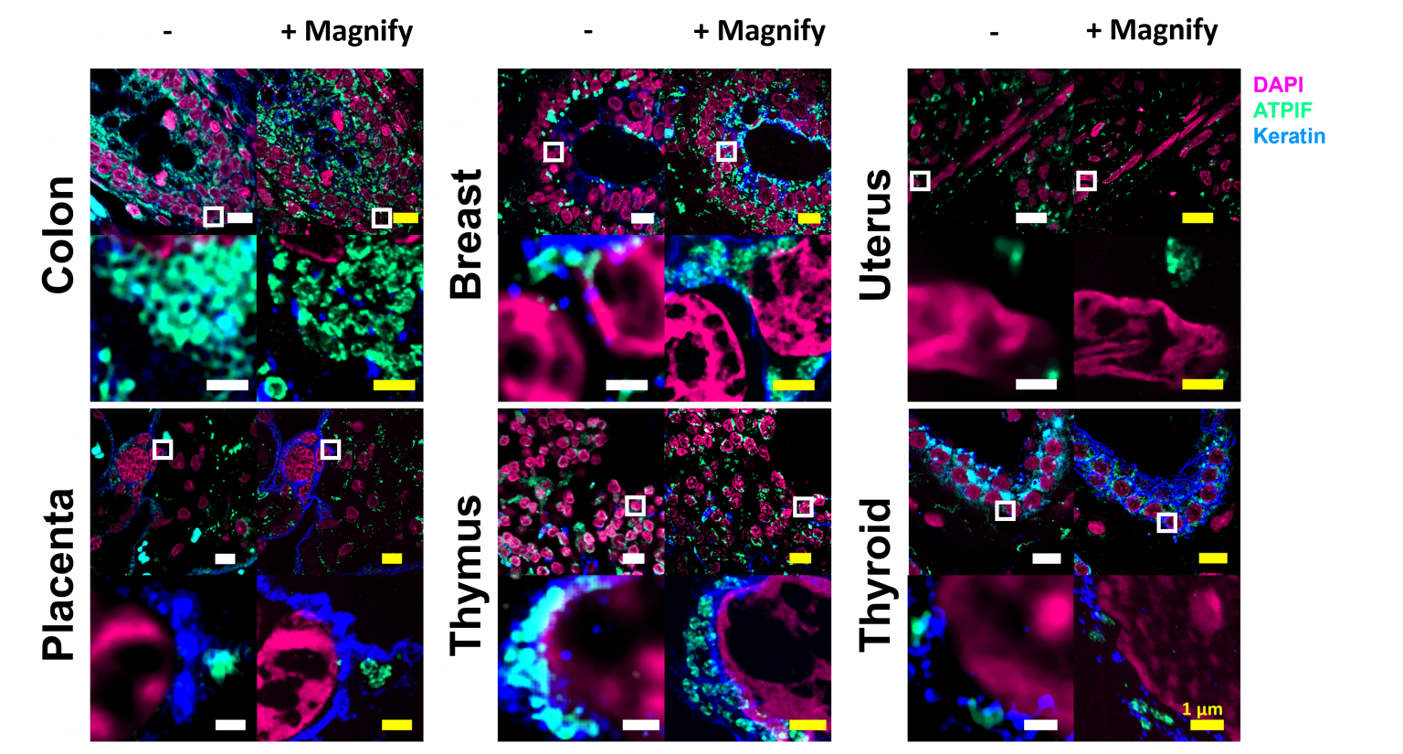 Magnify Biosciences, Inc. – Visualize the Future of Precision Medicine