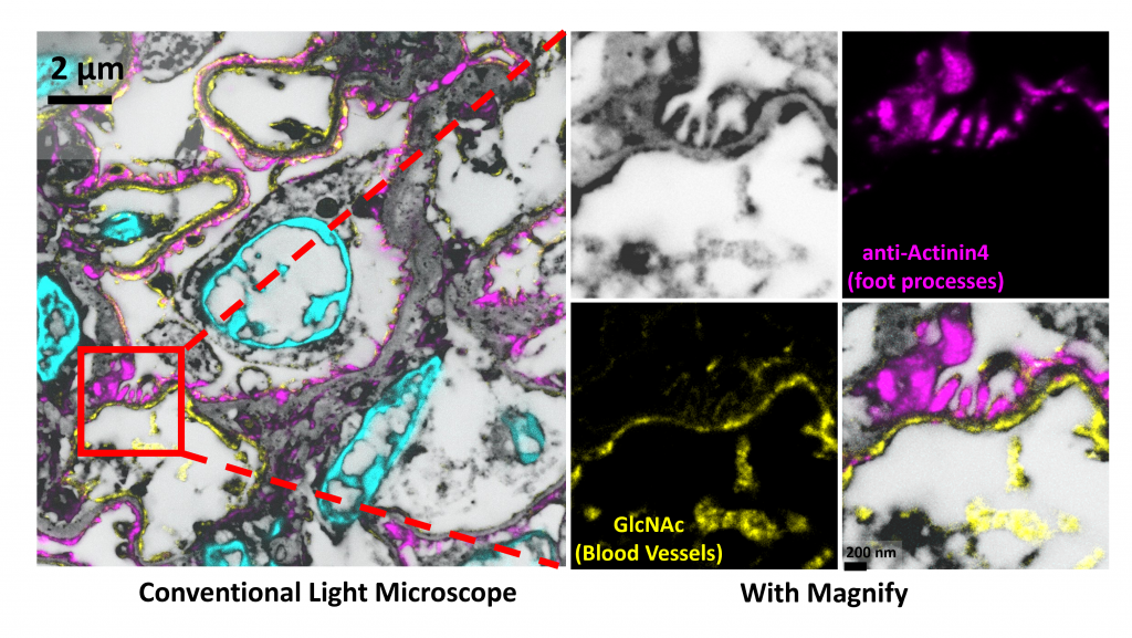 Magnify Biosciences, Inc. – Visualize the Future of Precision Medicine