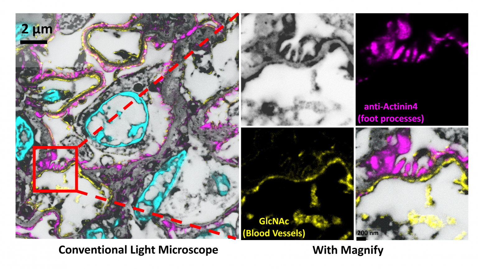 Magnify Biosciences, Inc. – Visualize the Future of Precision Medicine
