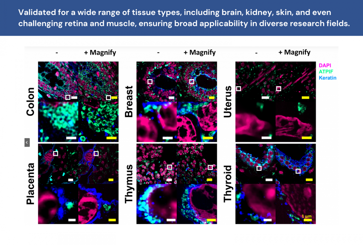 Magnify Biosciences, Inc. – Visualize the Future of Precision Medicine