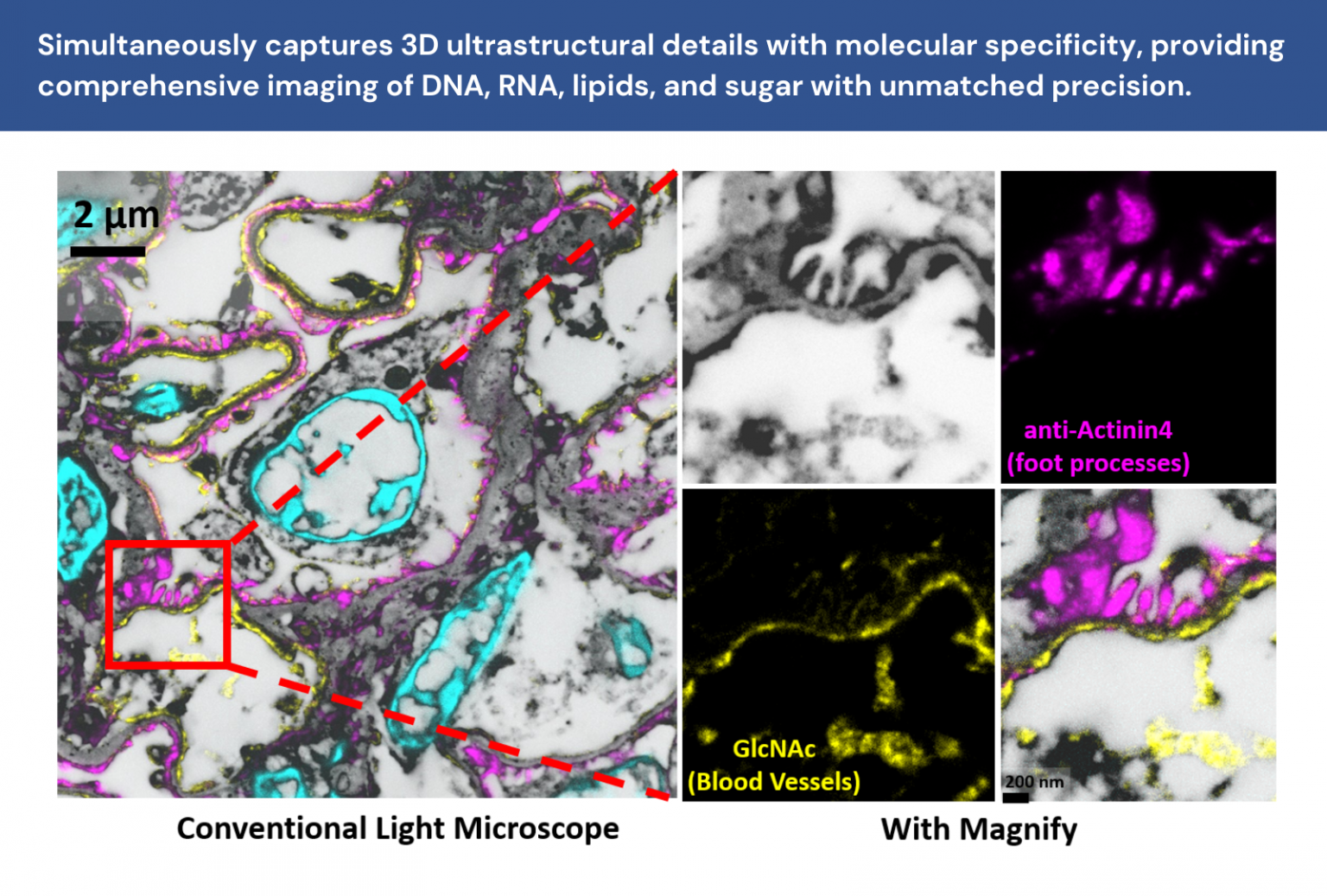 Magnify Biosciences, Inc. – Visualize the Future of Precision Medicine